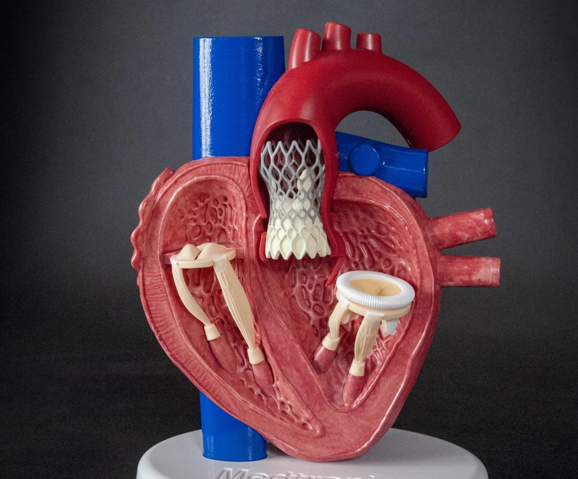 TAVI Expert in Jaipur - Transcatheter Aortic Valve Implantation Doctor